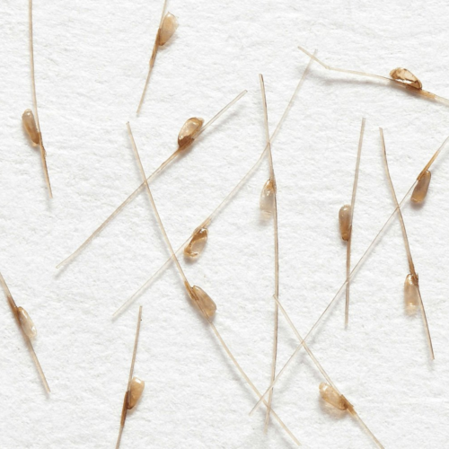 how to identify lice eggs (nits) and why they’re hard to remove – Lice ...