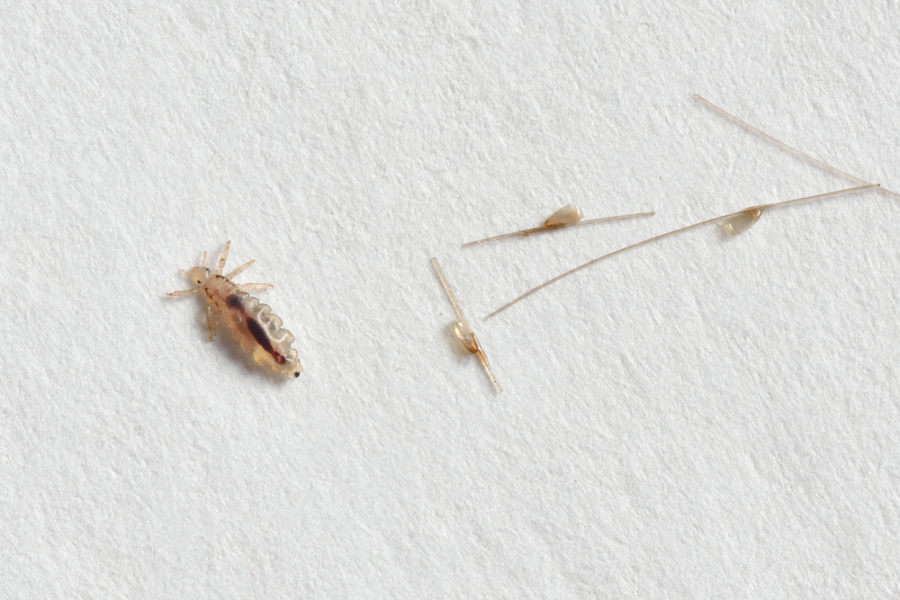 how long is the lice life cycle? – Lice Specialists – Lice Clinic Dubai